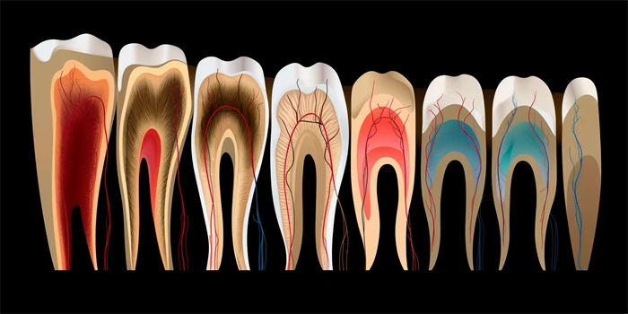 What Does a Catalyst in a Tooth Repair Kit Do - Ruli