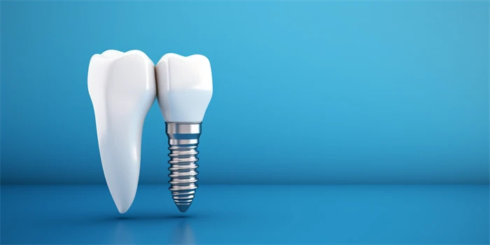Choosing Right Posterior Dental Bridge A Step-by-Step Guide - Ruli