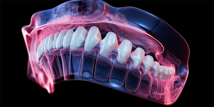 The Pros and Cons of Single Tooth Removable Partial - Ruli